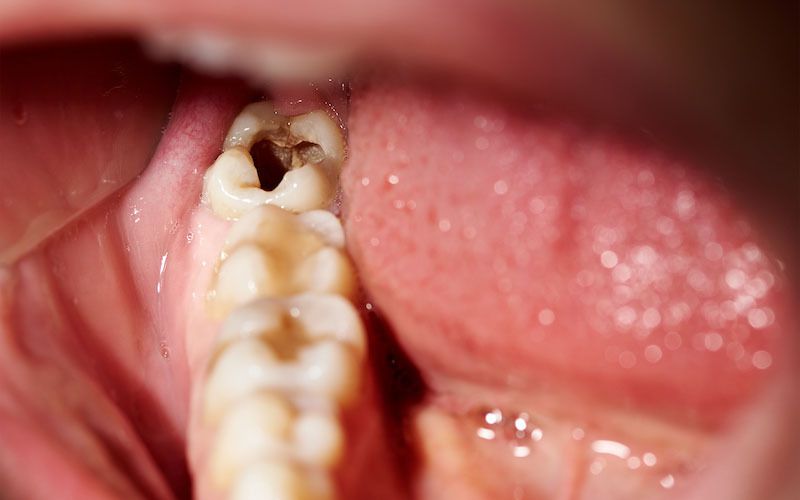 ngipin.info's Hangs - LockerDome